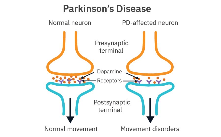 Parkinson's Disease | Axion Biosystems
